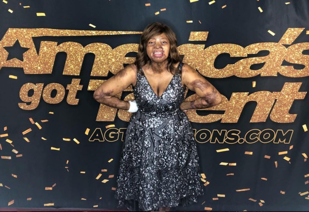 AMERICA'S GOT TALENT: THE CHAMPIONS! Kechi Okwuchi gets Golden Buzzer ...